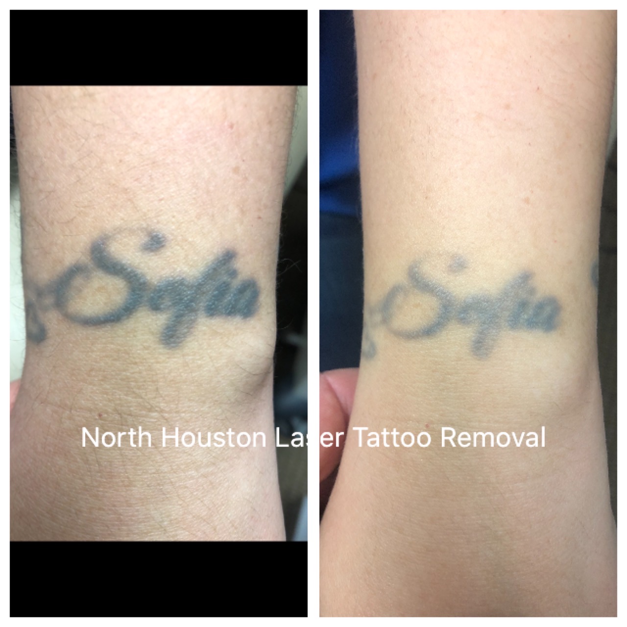 How Long Will It Take Before I See My Tattoo Fade North Houston How Long Will It Take Before I See My Tattoo Fade North Houston